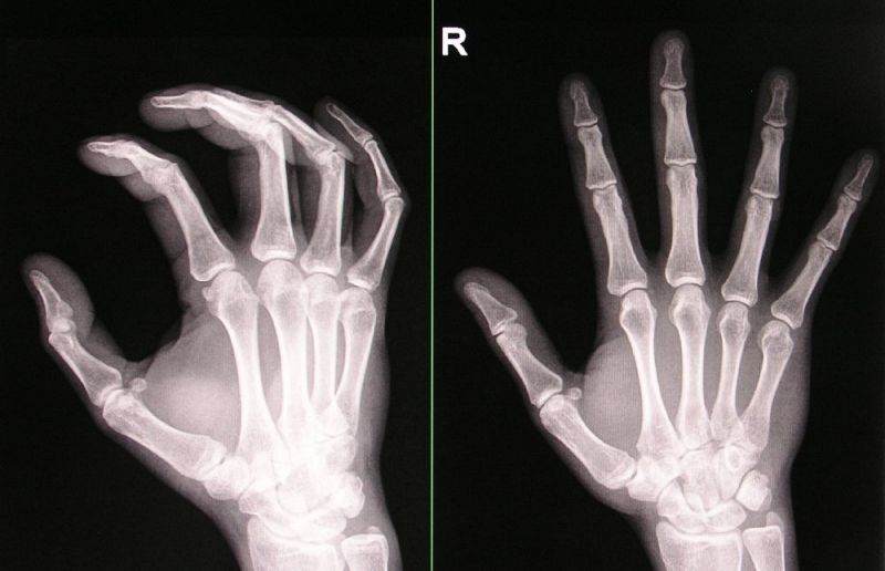 Rentgenové vyšetření | uLékaře.cz